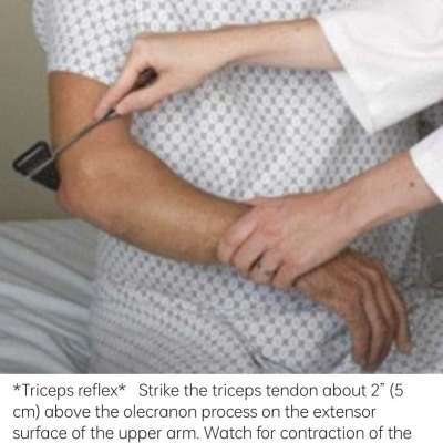 Eliciting deep tendon reflexes There are five dee..