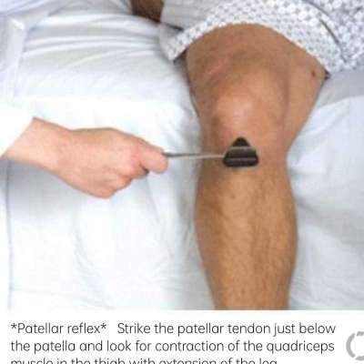 Eliciting deep tendon reflexes There are five dee..